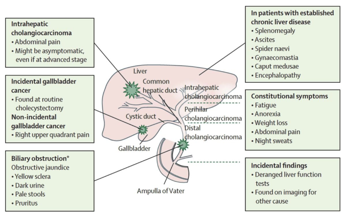 Symptoms - Cholangiocarcinoma Australia